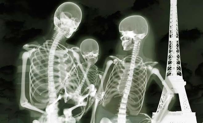 Hugh Turvey X Ray Artist Creates Art Photos- X-Ray मशीन बन जाए कैमरा तो ...